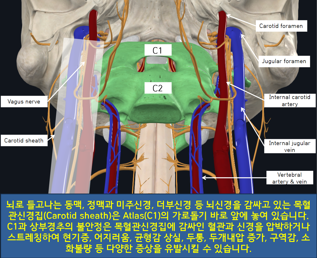어지럼증 이석증 균형감 상실 현기증의 숨은 원인은 두개경추불안정 이수척한의원